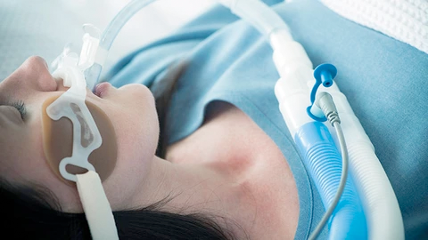 HUMIDIFICACIÓN PARA LA VENTILACIÓN INVASIVA. | GSIM